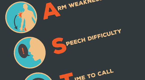 How to Prevent a Stroke – The Queen′s Health Systems